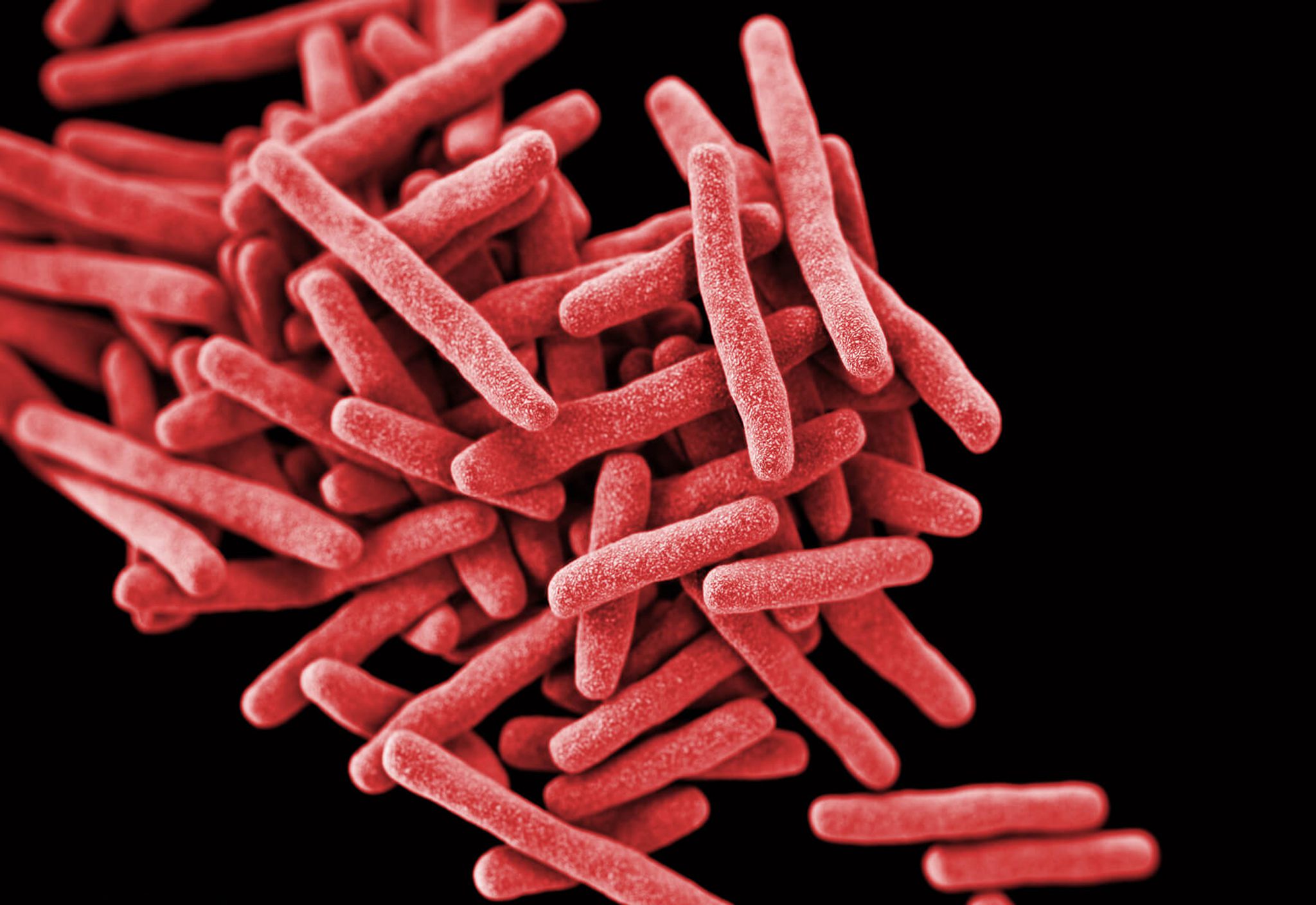 A Doença da Lepra – Doenças Tropicais Negligenciadas